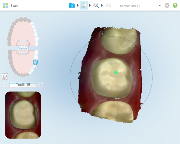 iTero Element® Intraoral Scanner - glidewell.io