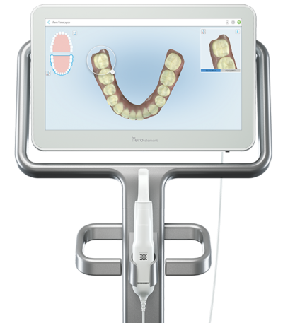 iTero Element® Intraoral Scanner - glidewell.io