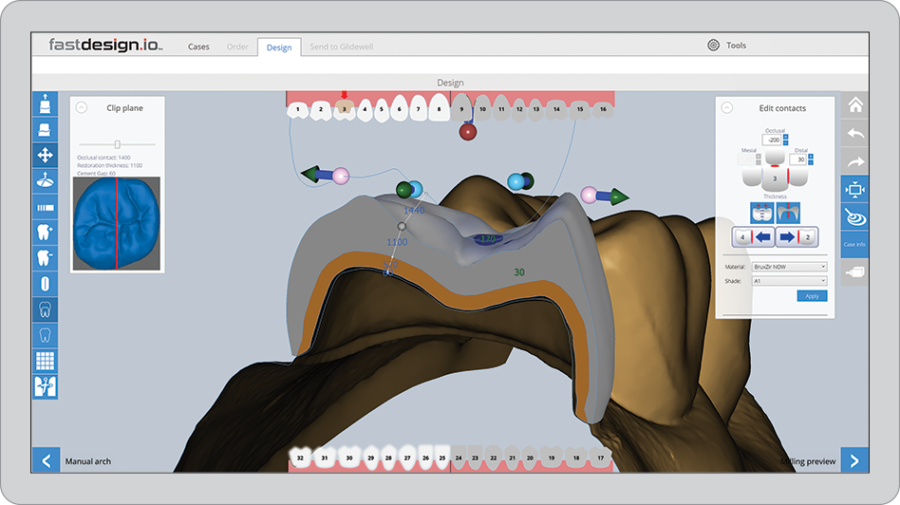 fastdesign.io™ Software - glidewell.io